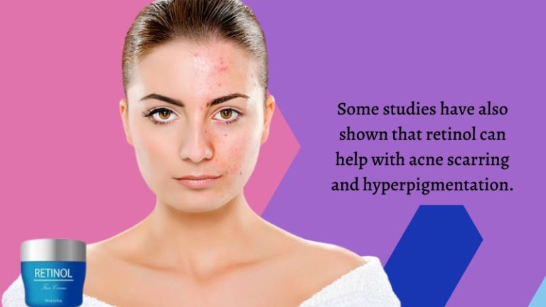 Benefits of Retinol for a Glowing Skin